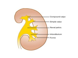 Infundibular In Kidney