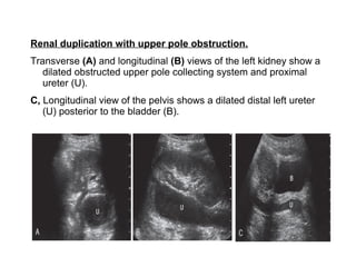 Normal Left Kidney Ultrasound