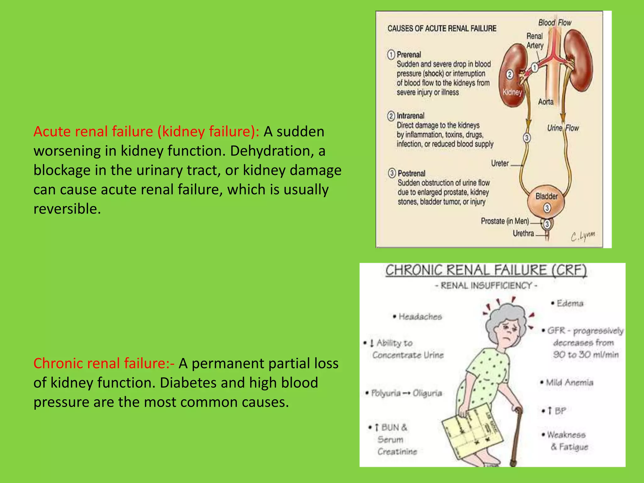 Kidney anatomy - Almaskhan .khorfakhan hospital | PPTX