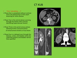 Kidney anatomy - Almaskhan .khorfakhan hospital | PPTX