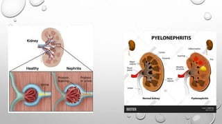kidney anatomy ppt.pptx