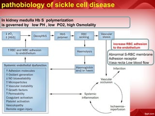 Kidney and scd | PPT | Blood Disorders | Diseases and Conditions