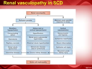 Kidney and scd | PPT | Blood Disorders | Diseases and Conditions