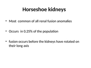 The kidney and The ureters Agenesis.ppt