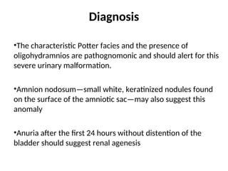 The kidney and The ureters Agenesis.ppt