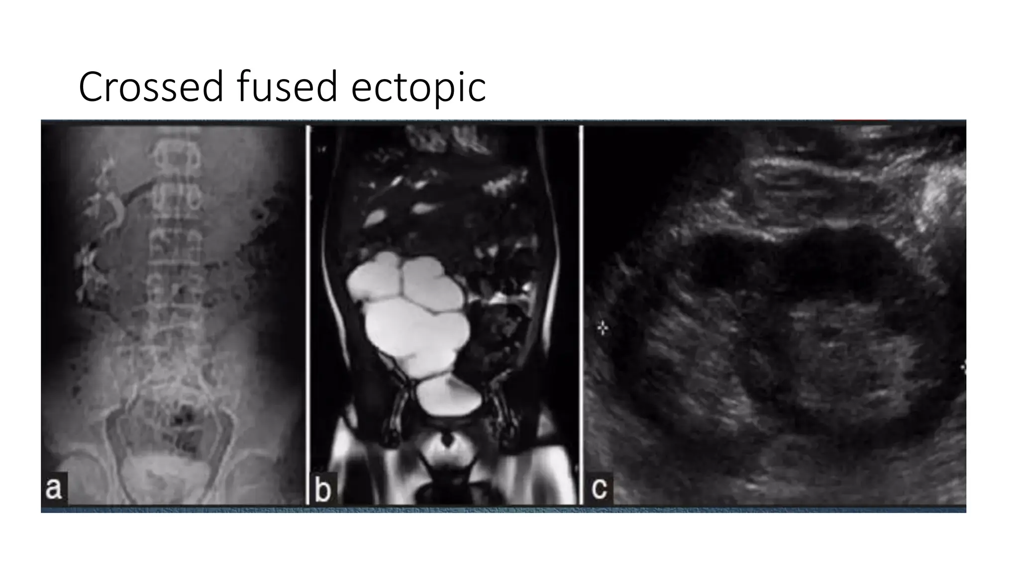 KIDNEY AND URINARY TRACT IMAGING AND FINDINGS | PPTX