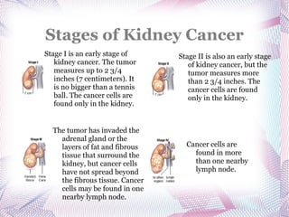 Kidney Cancer | ODP