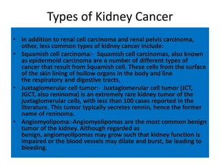 Kidney cancer.. | PDF | Cancer | Diseases and Conditions