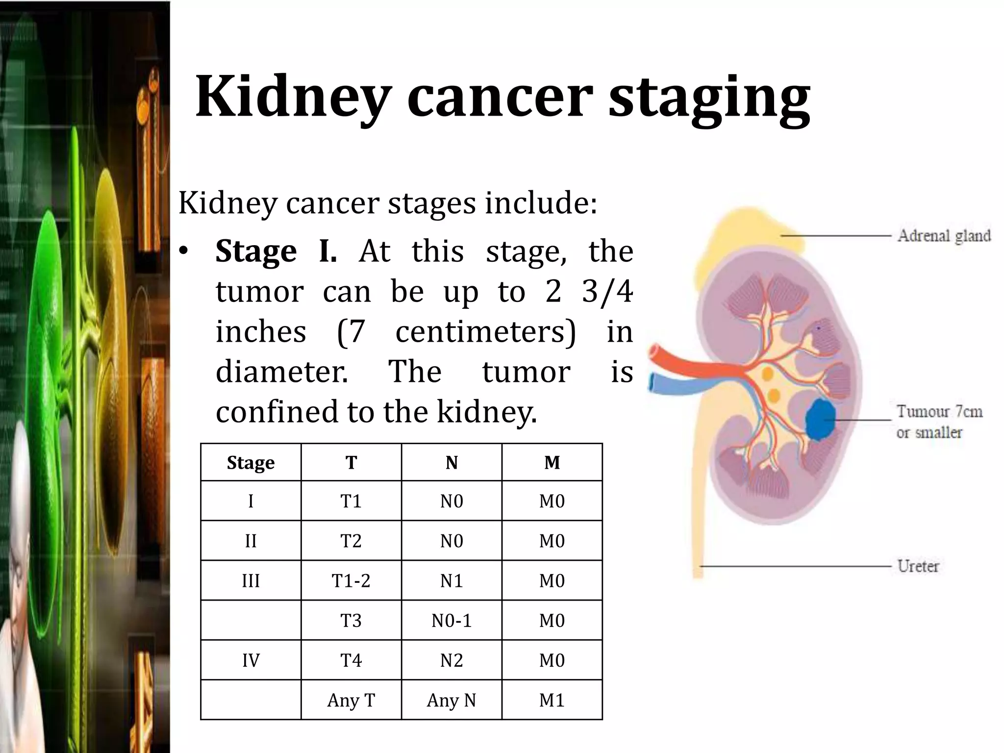 Kidney cancers | PPSX