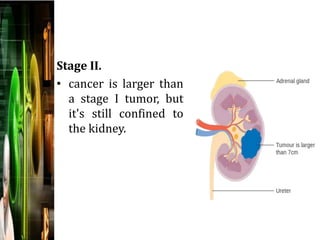 Kidney cancers | PPSX