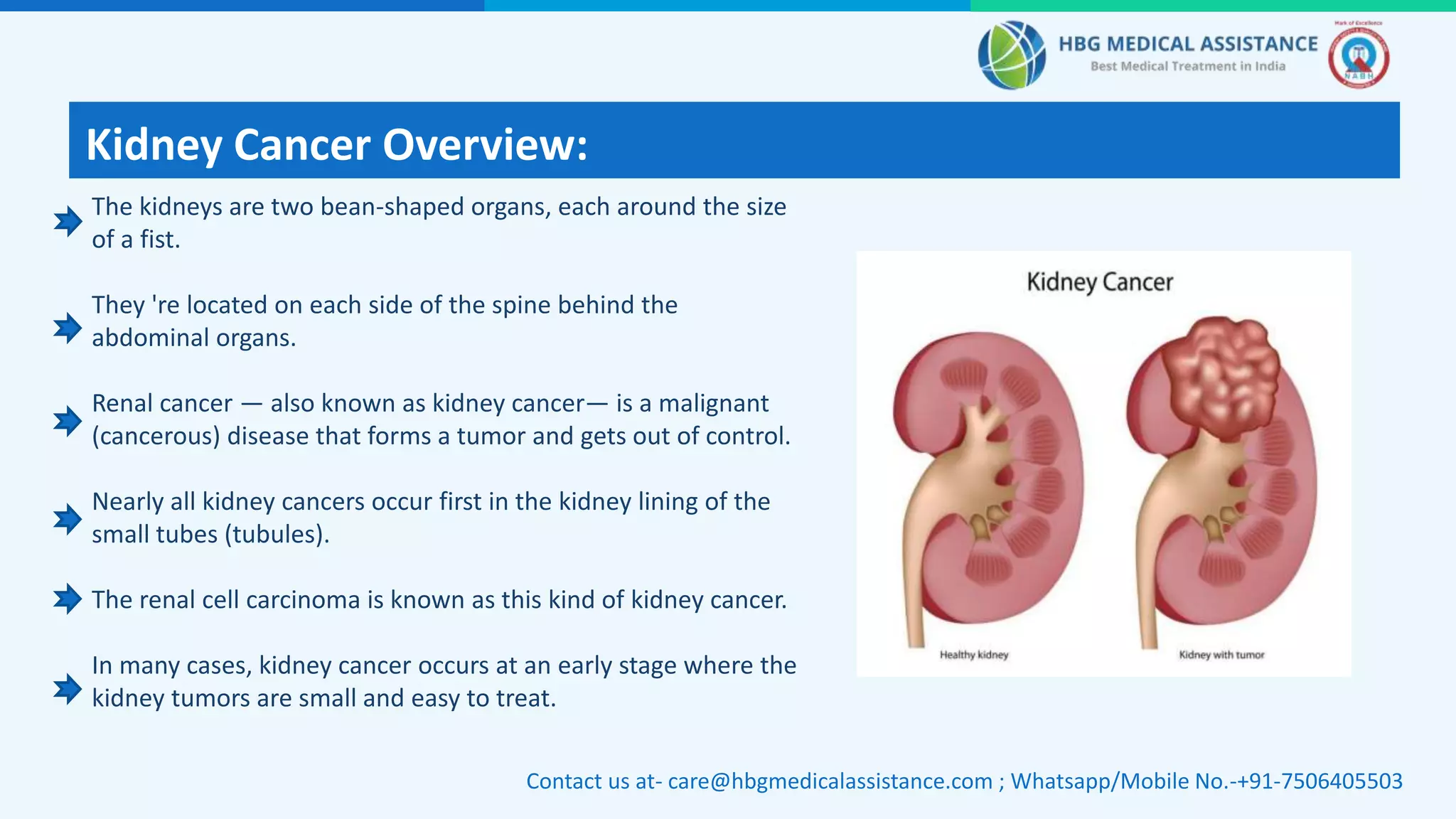 Kidney Cancer Treatment Options In India | PPT