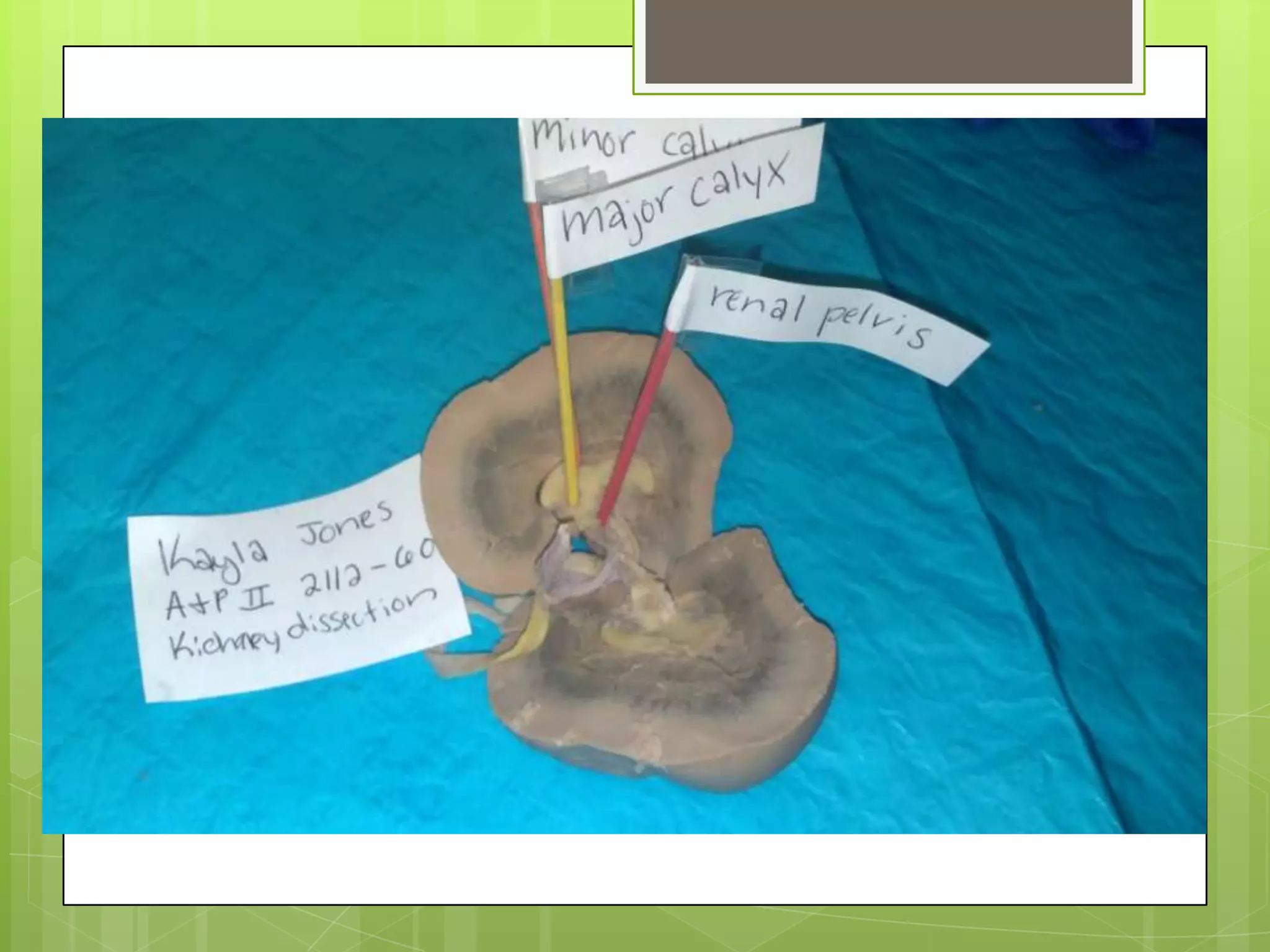 Kidney dissection | PPTX