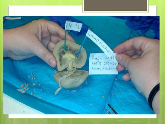 Kidney dissection | PPTX | Surgery | Medical Health