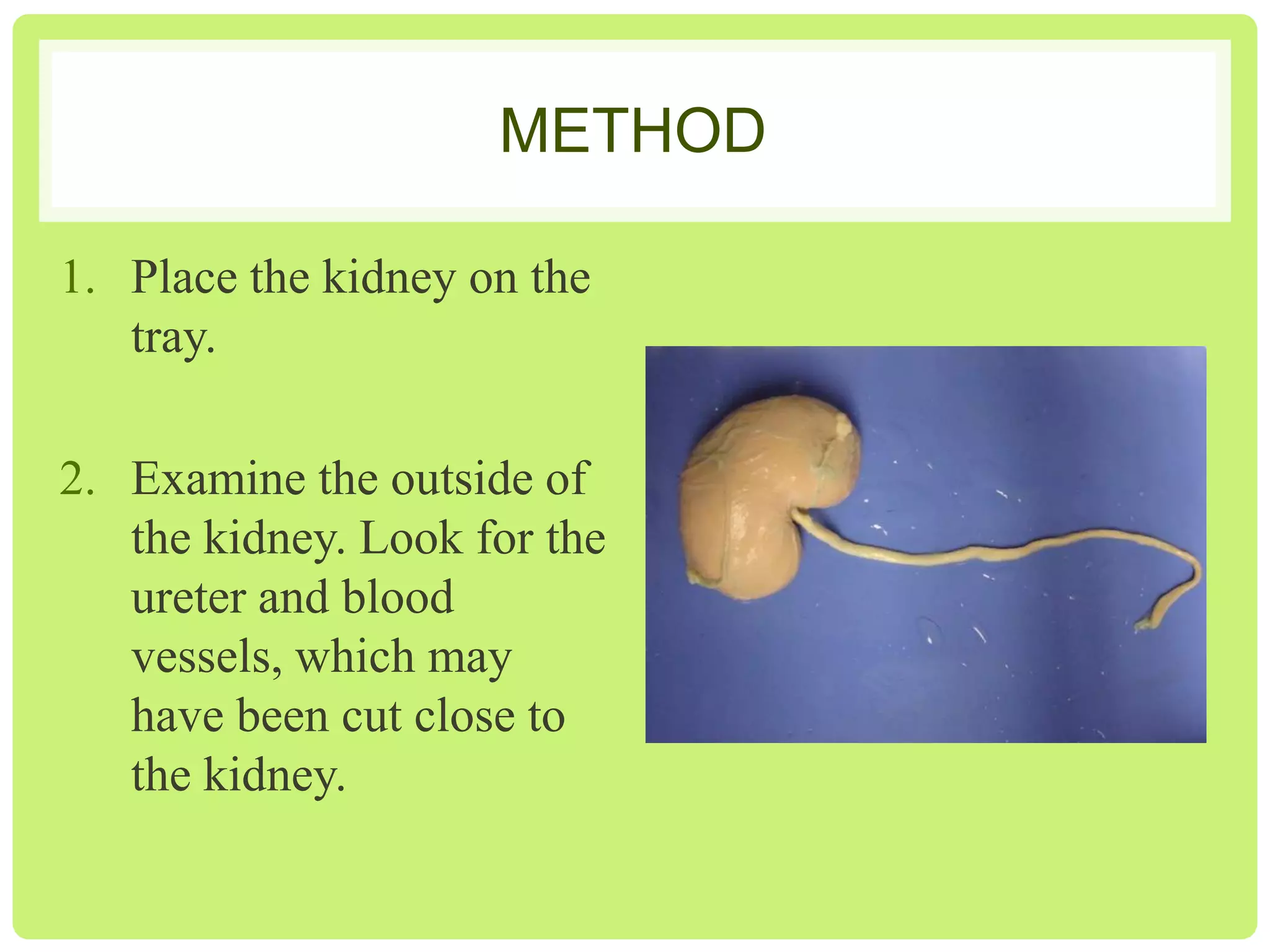 Kidneydissectionprac | PPTX