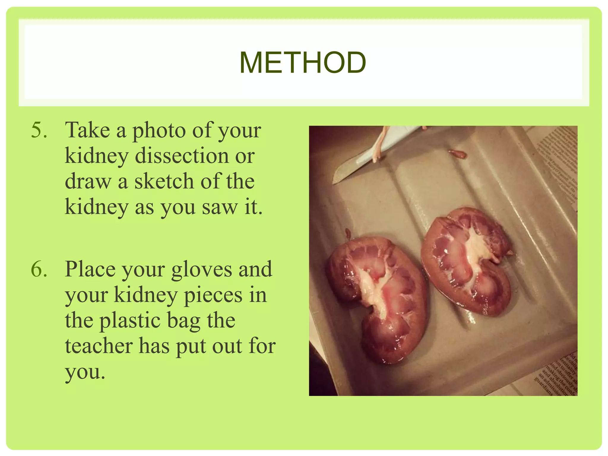 Kidneydissectionprac | PPTX