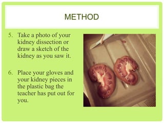 Kidneydissectionprac | PPTX