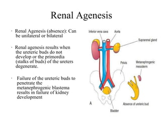 Kidney embryology | PPTX