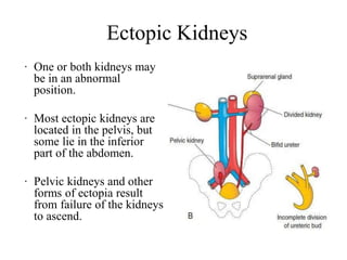 Kidney embryology | PPTX