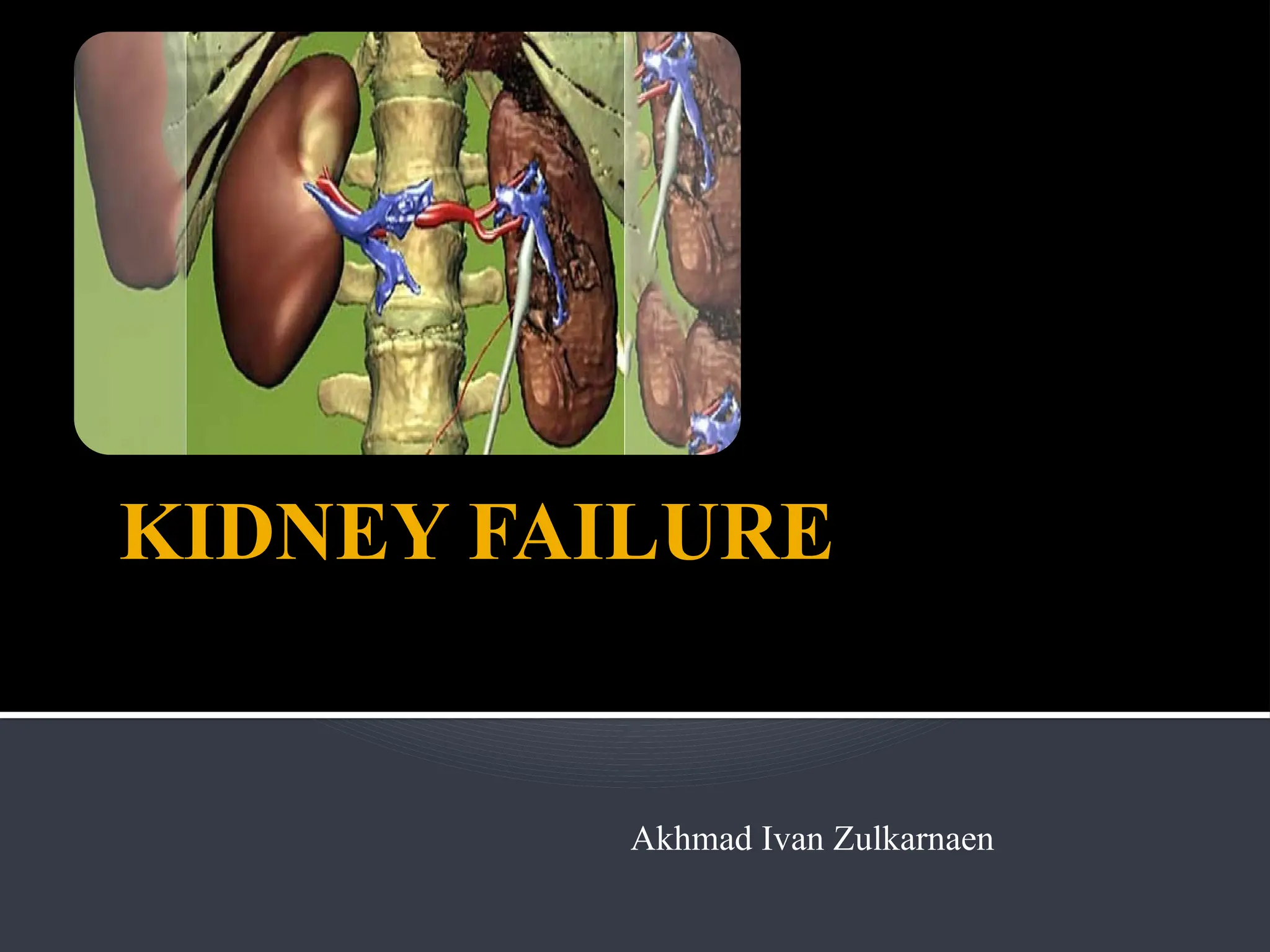 Understanding Kidney Failure: Causes, Symptoms, and Treatment Options | PPTX