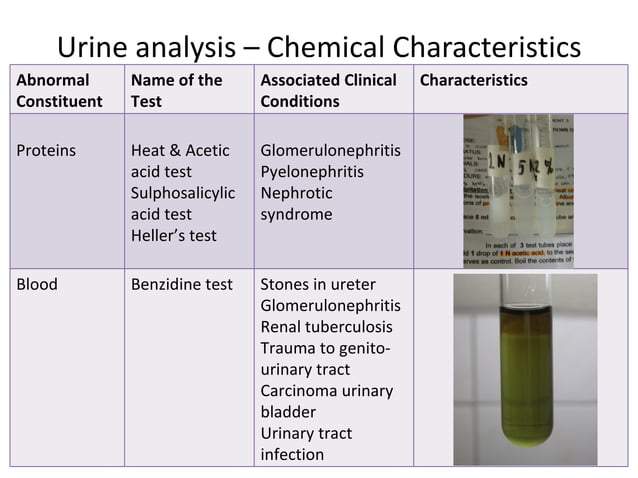 Kidney function test