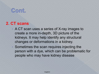 Kidney function test | PPTX