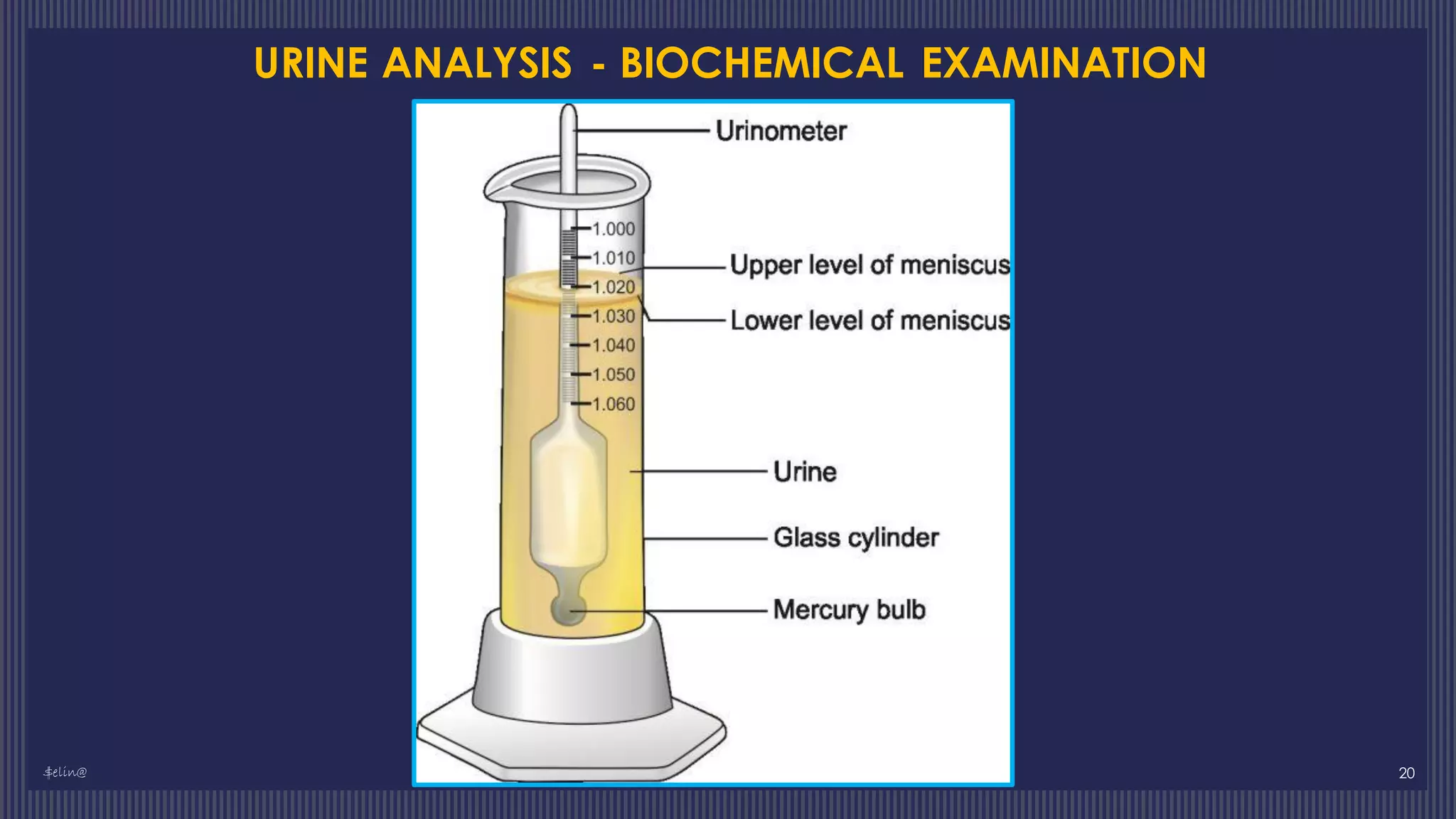 Kidney function test physical macroscopic and microscopic tests | PDF