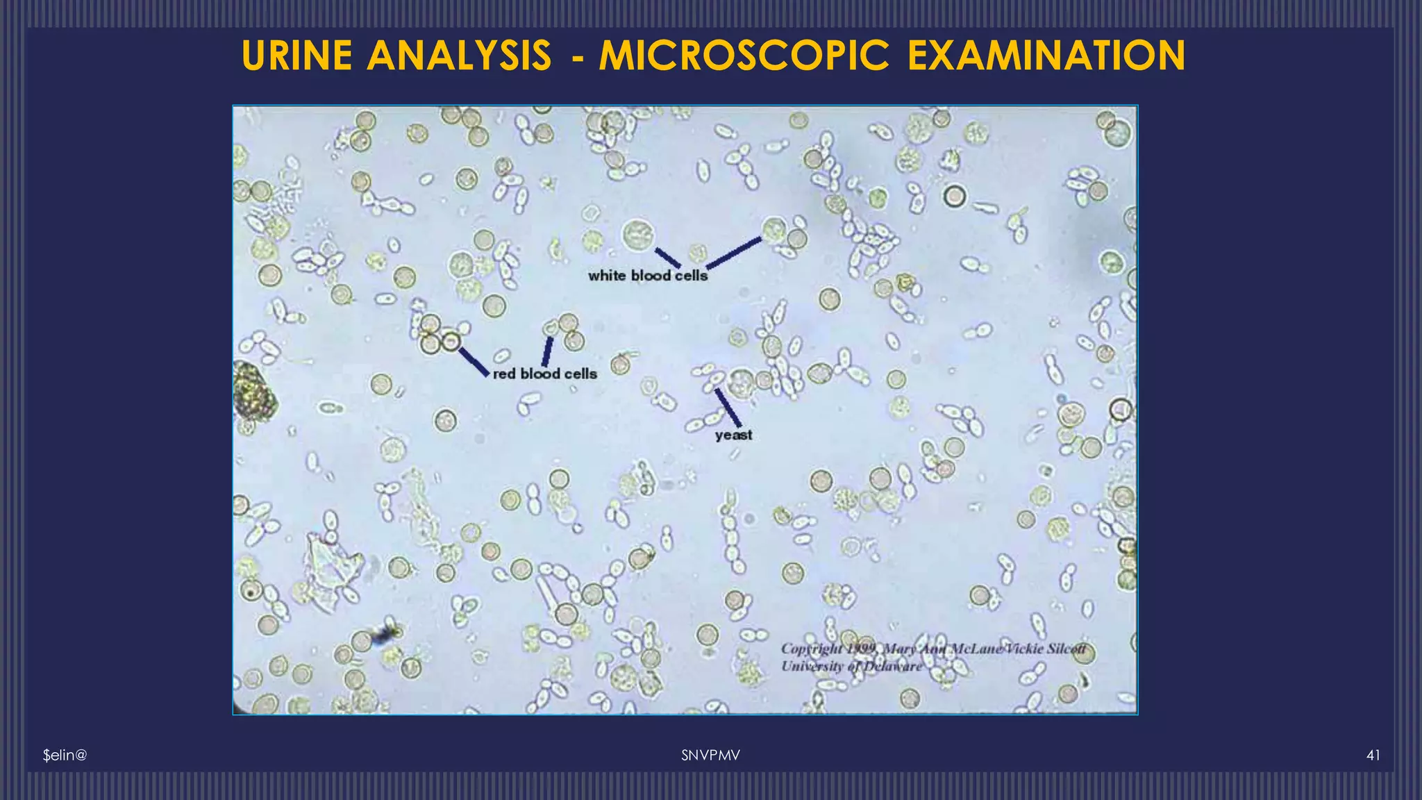 Kidney function test physical macroscopic and microscopic tests | PDF