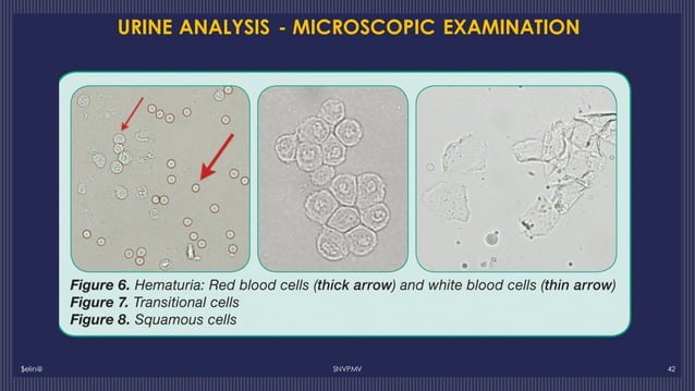 Kidney function test physical macroscopic and microscopic tests | PPT