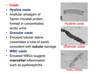 kidney function tests and its interpretation | PPTX