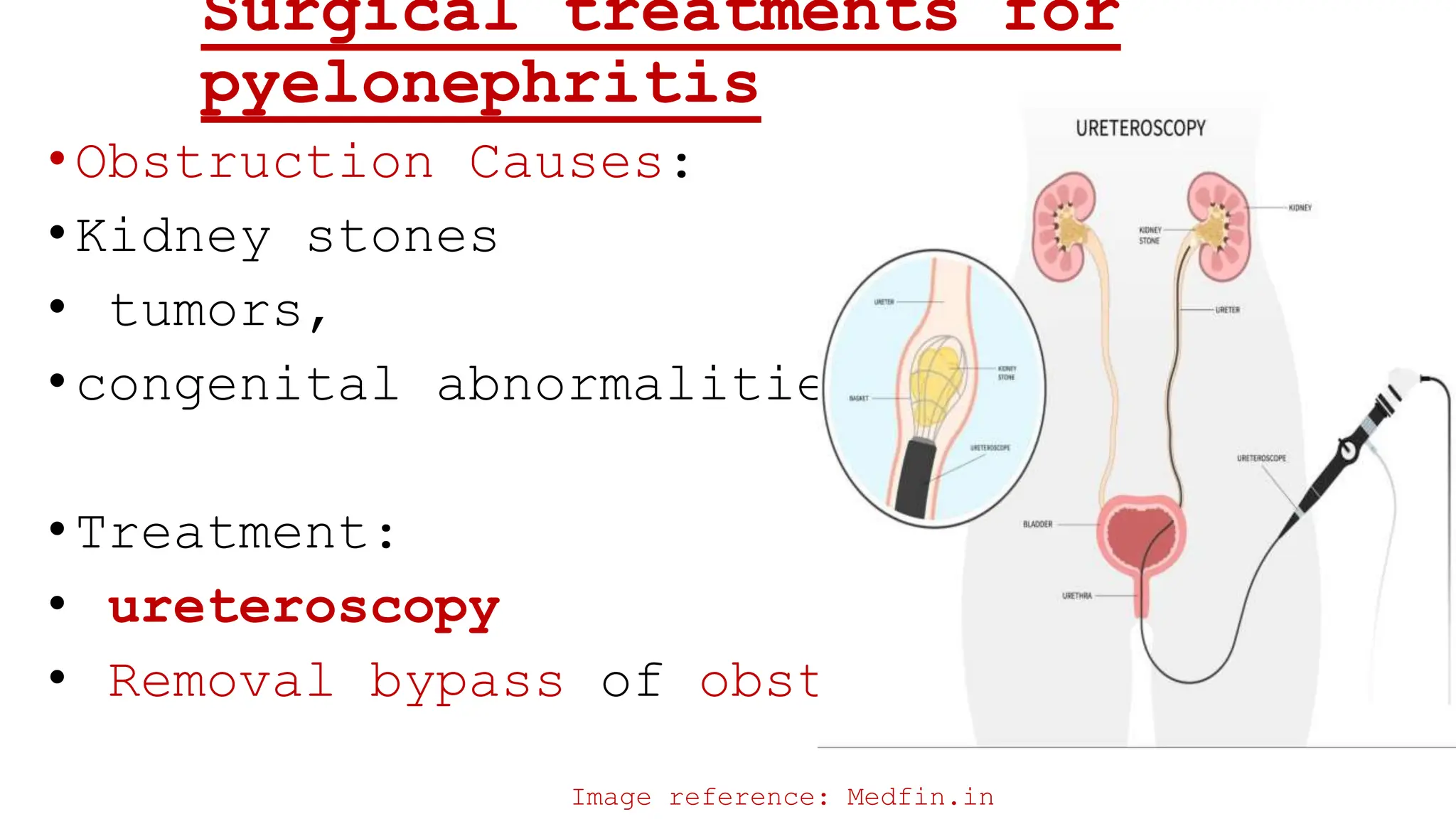 kidney infections(pyelonephritis)_surgery and medicine. | PPT
