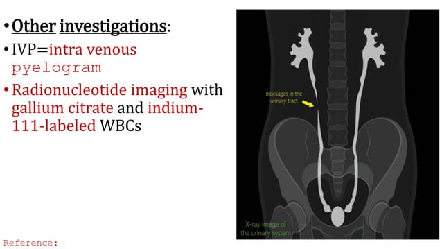 kidney infections(pyelonephritis)_surgery and medicine. | PPT