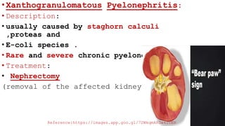 kidney infections(pyelonephritis)_surgery and medicine. | PPTX