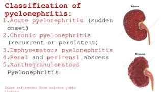 kidney infections(pyelonephritis)_surgery and medicine. | PPT