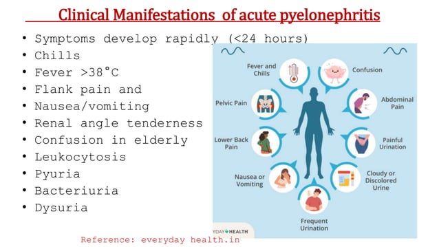 kidney infections(pyelonephritis)_surgery and medicine. | PPT