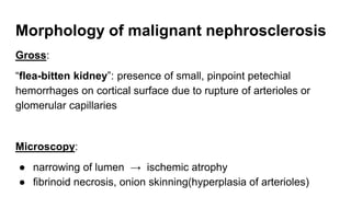 Kidney in hypertension - Pathology - RDT | PPTX