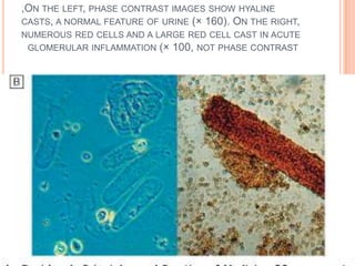 medicine.Kidney lecture 1.(dr.ala) | PPTX | Endocrine and Metabolic ...