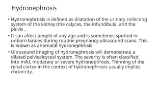 KIDNEY PATHOLOGIES.pptx BY NNADI NGOZI T | PPTX