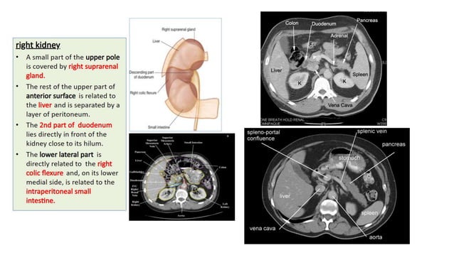 Kidney anatomy and ct ppt.pptx