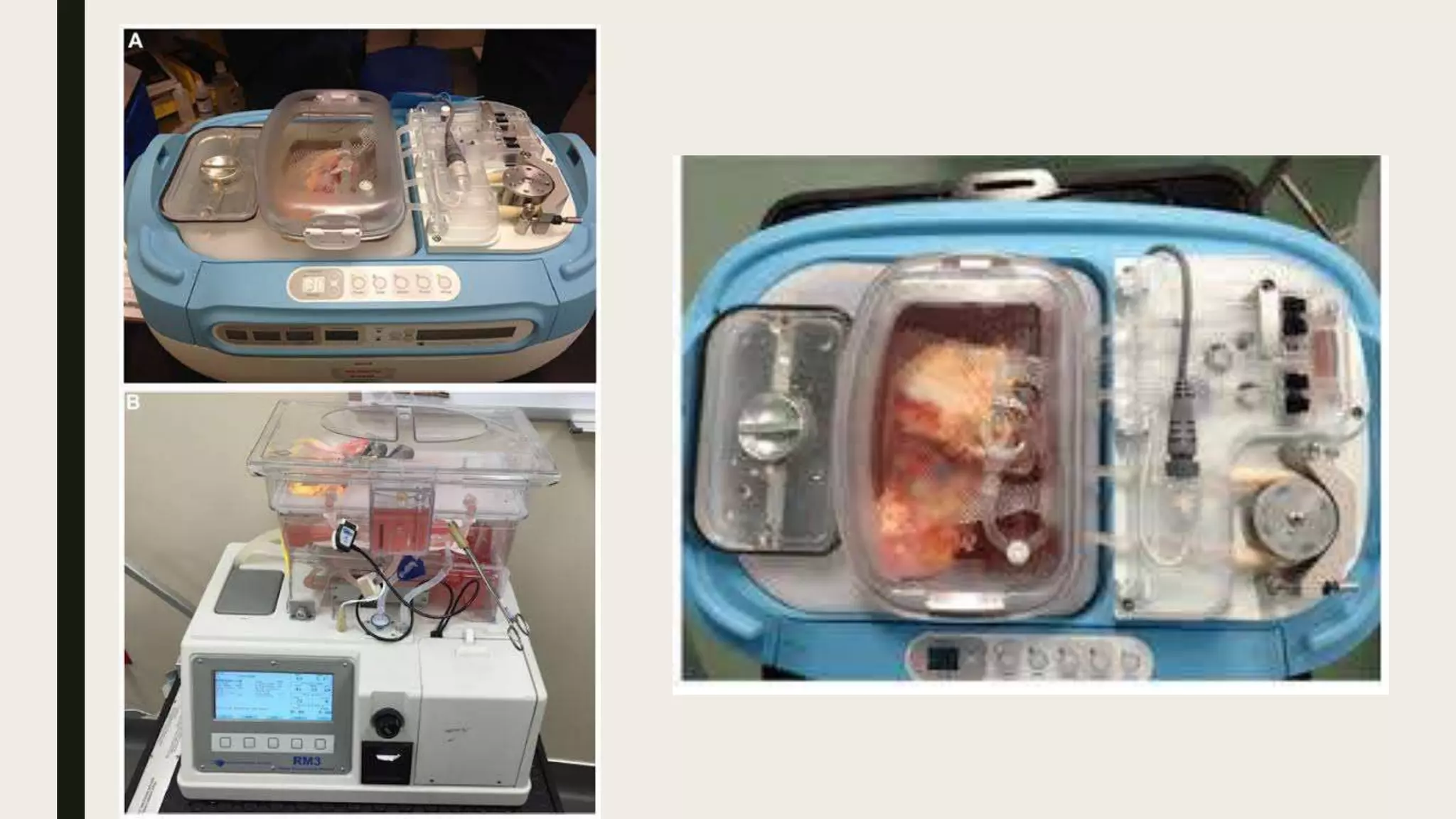 Kidney preservation-1.pptx