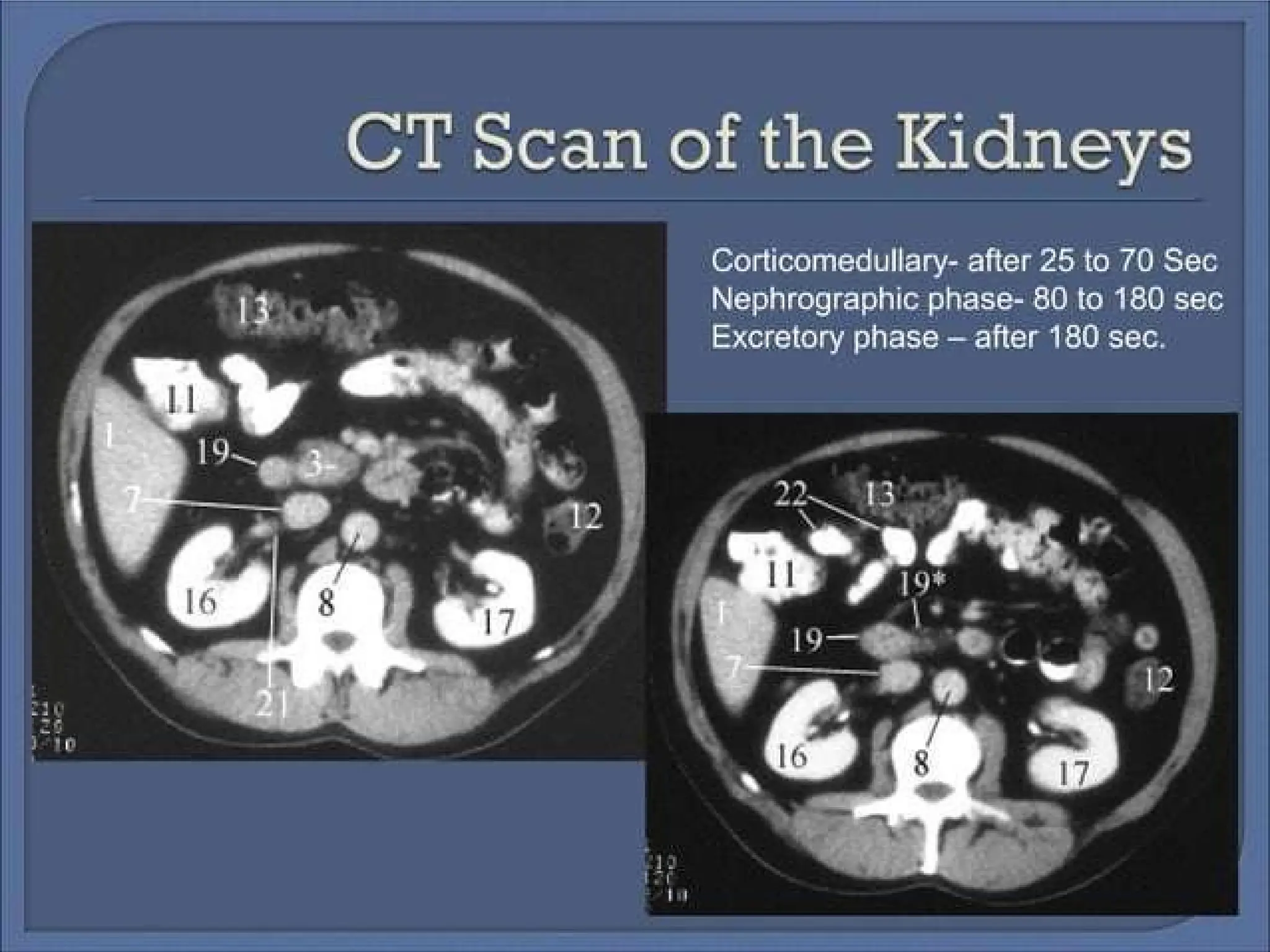 Kidney anatomy presentation and lower genitourinary system | PPT
