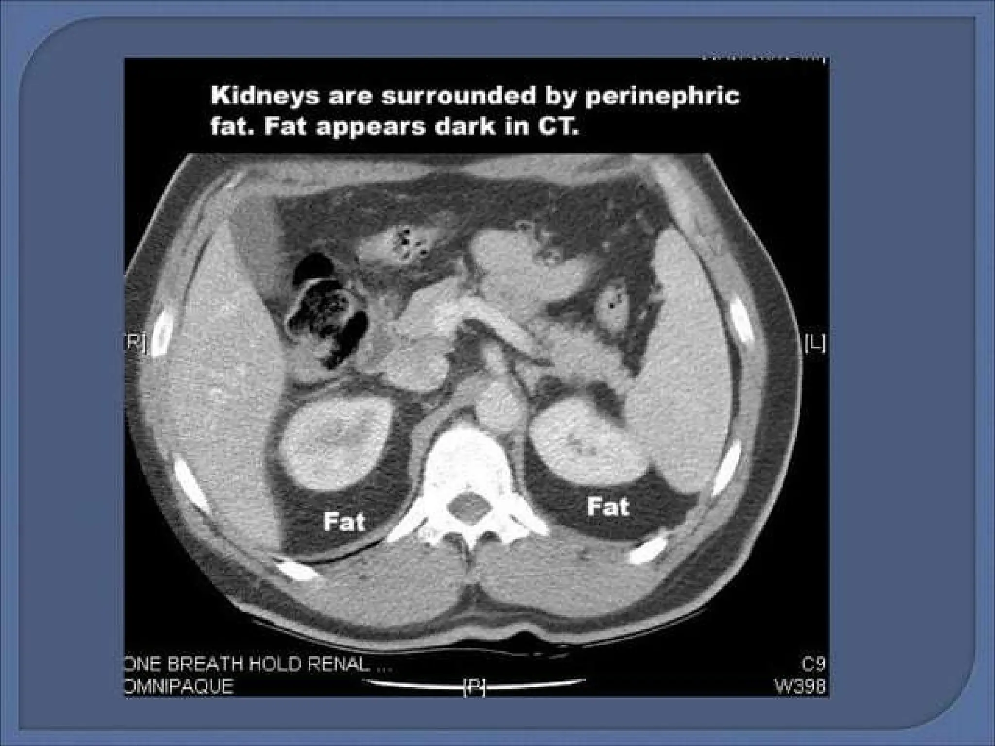 Kidney anatomy presentation and lower genitourinary system | PPT