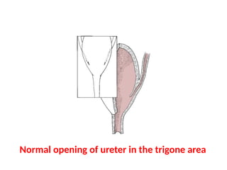 Kidneys and ureters small animal surgery.pptx