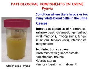 Kidneys CLINICAL biochemistry.ppt111111111 | PPT | Blood Disorders ...