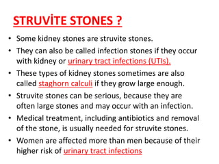 Ki̇dney stone | PPTX
