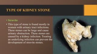 Ayurvedic Treatment of Kidney Stone | PPTX