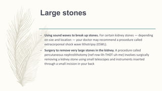 Kidney stone | PPTX