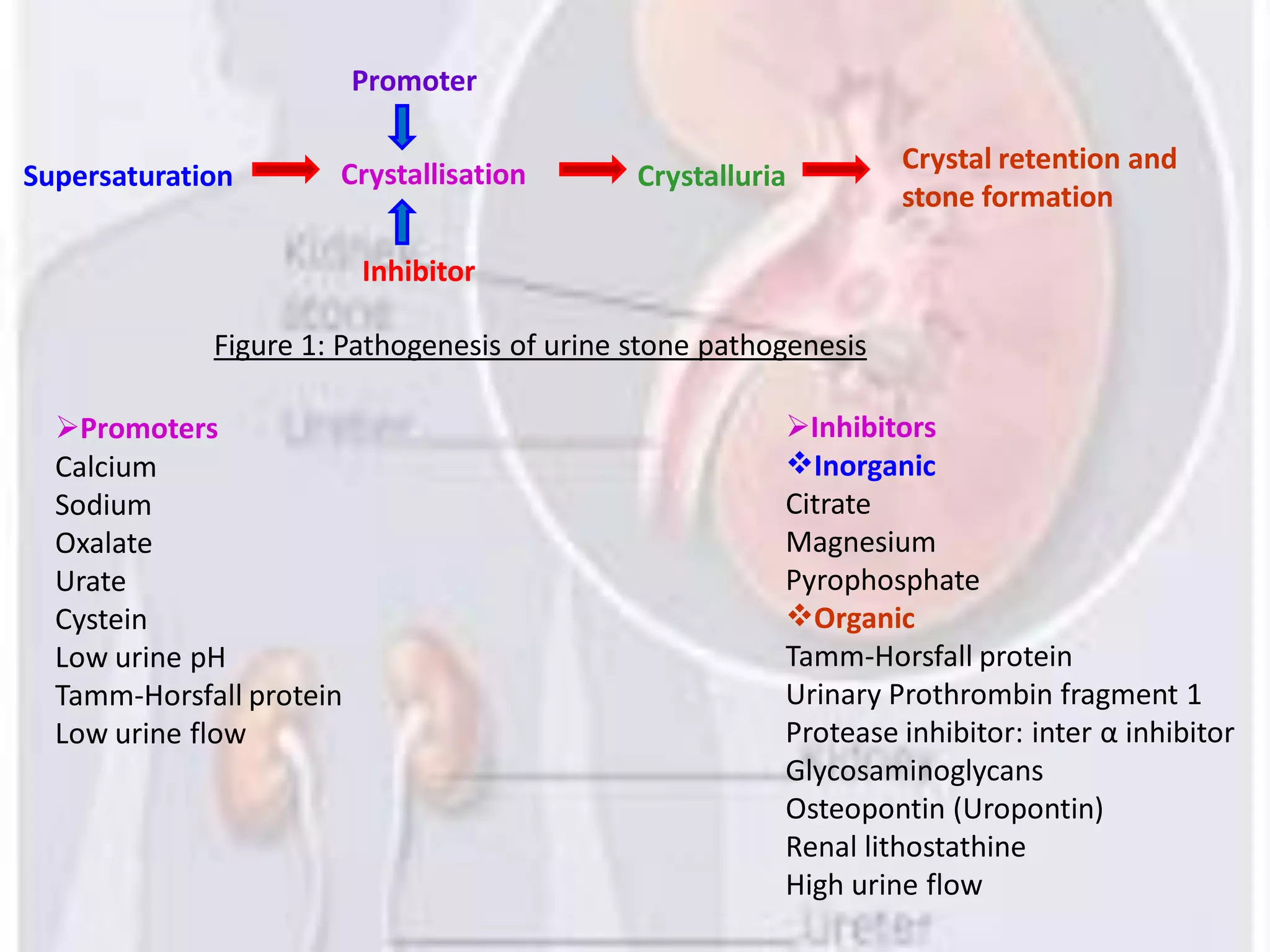Kidney stone | PDF