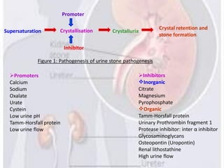 Kidney stone | PPT