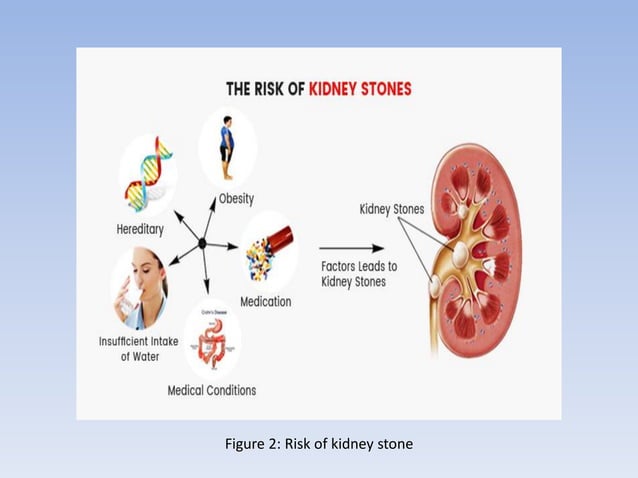 Kidney stone | PPT