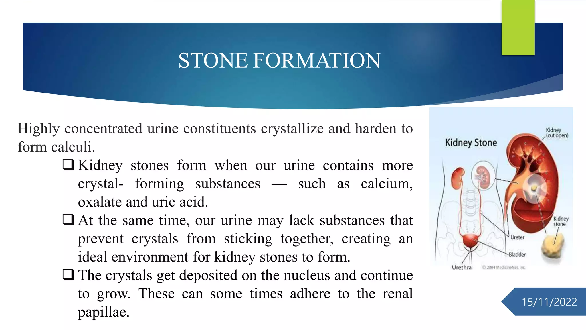 Kidney Stone.pptx